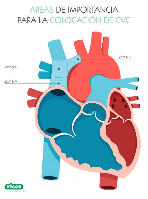 Áreas de importancia para la colocación de CVC - Campus Vygon Chile
