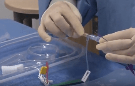 Catéter PICC: Colocación y comparativa de Pilot y Sherlock