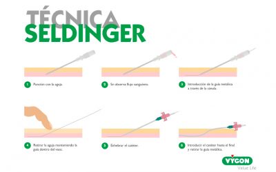 Técnica Seldinger archivos - Campus Vygon España