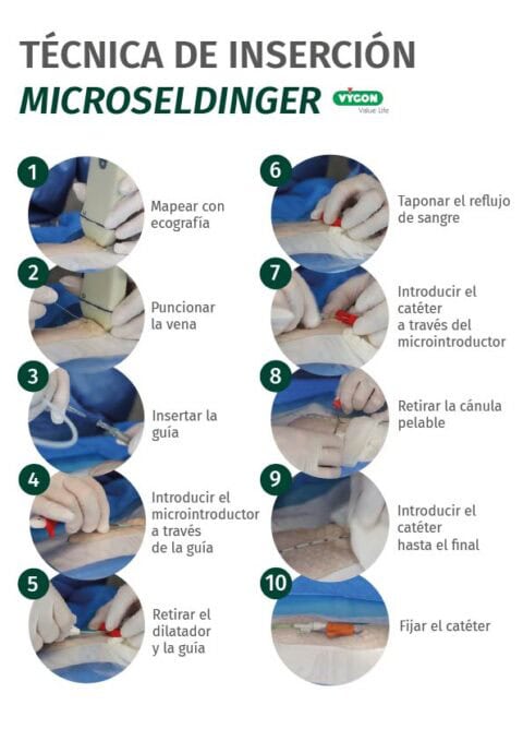 Seldinger con Midline vs Microseldinger con PICC