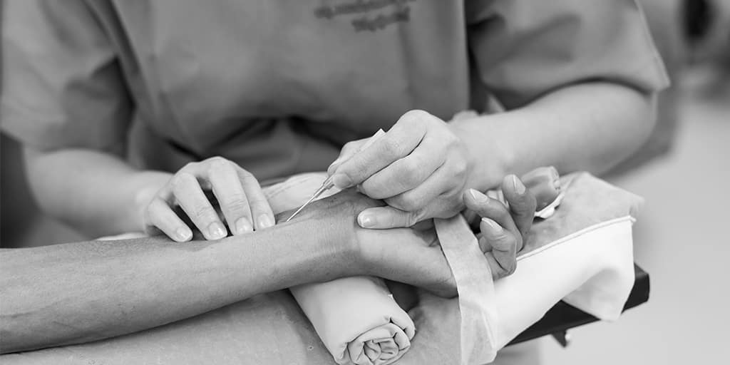 ¿Sabías qué... el material del catéter arterial influye en la calidad ...