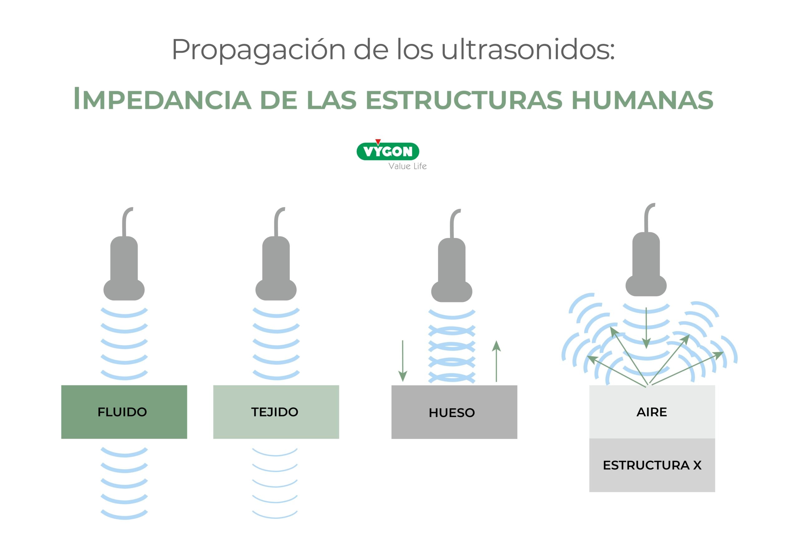 Propagación de los ultrasonidos - Impedancia de las estructuras humanas ...
