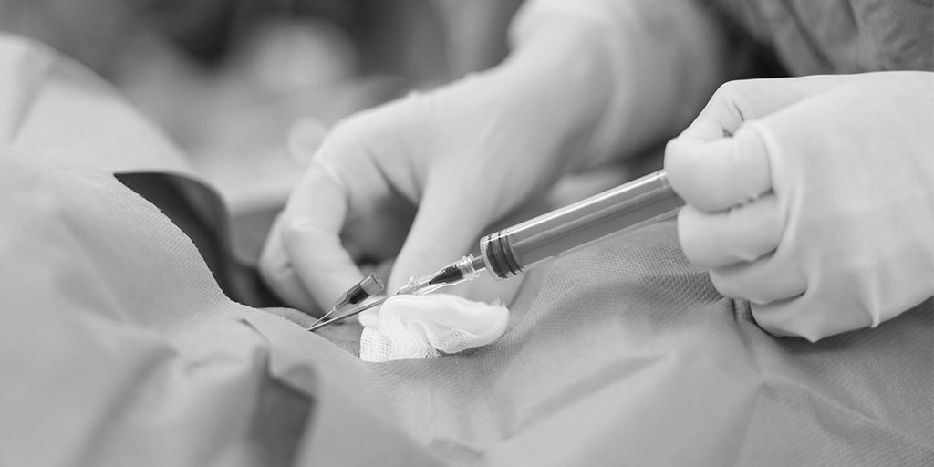 10 claves para la colocación segura del CVC en la vena yugular interna ...