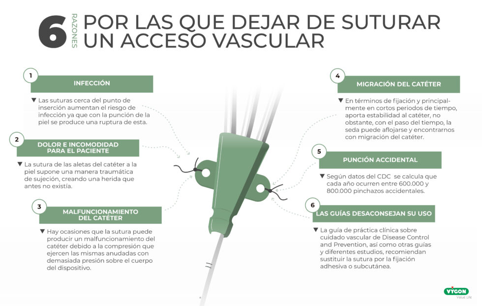 Sistemas de fijación del catéter venoso central: ¿cuál es la opción más ...