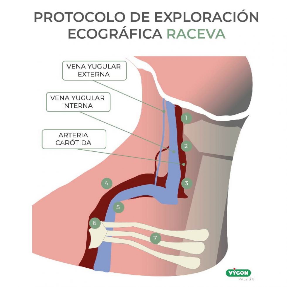 Capital venoso: La relevancia de una gestión eficiente del