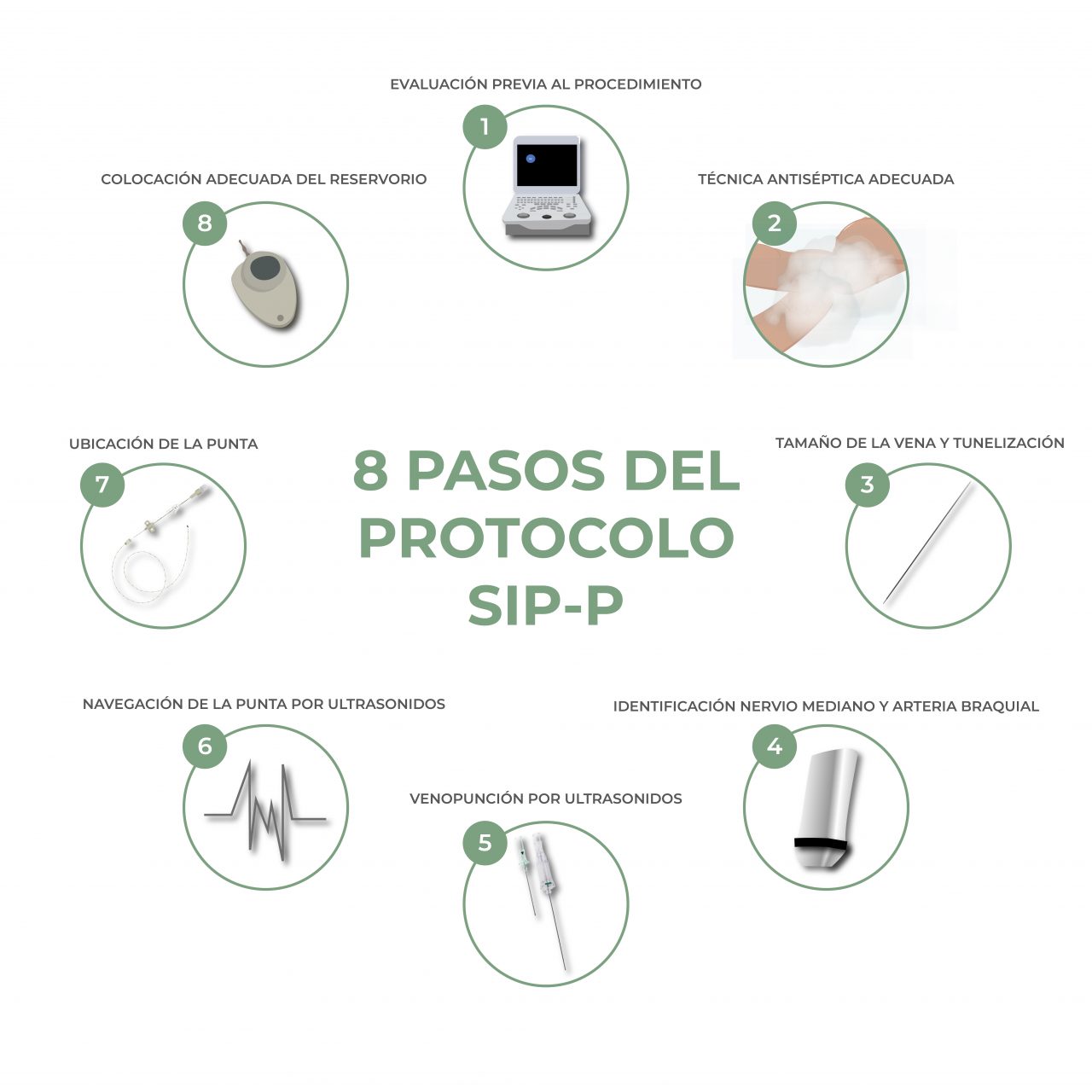 8 pasos del protocolo SIP-P - Campus Vygon España