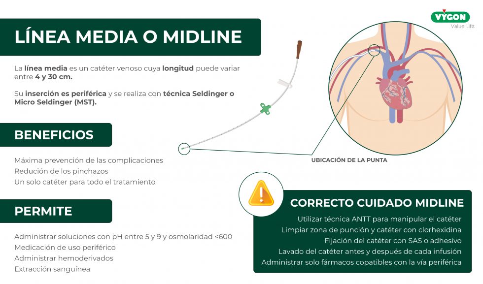 Línea media o Midline - Campus Vygon España