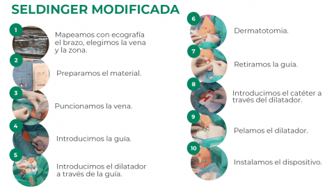 Técnica Seldinger y Microseldinger