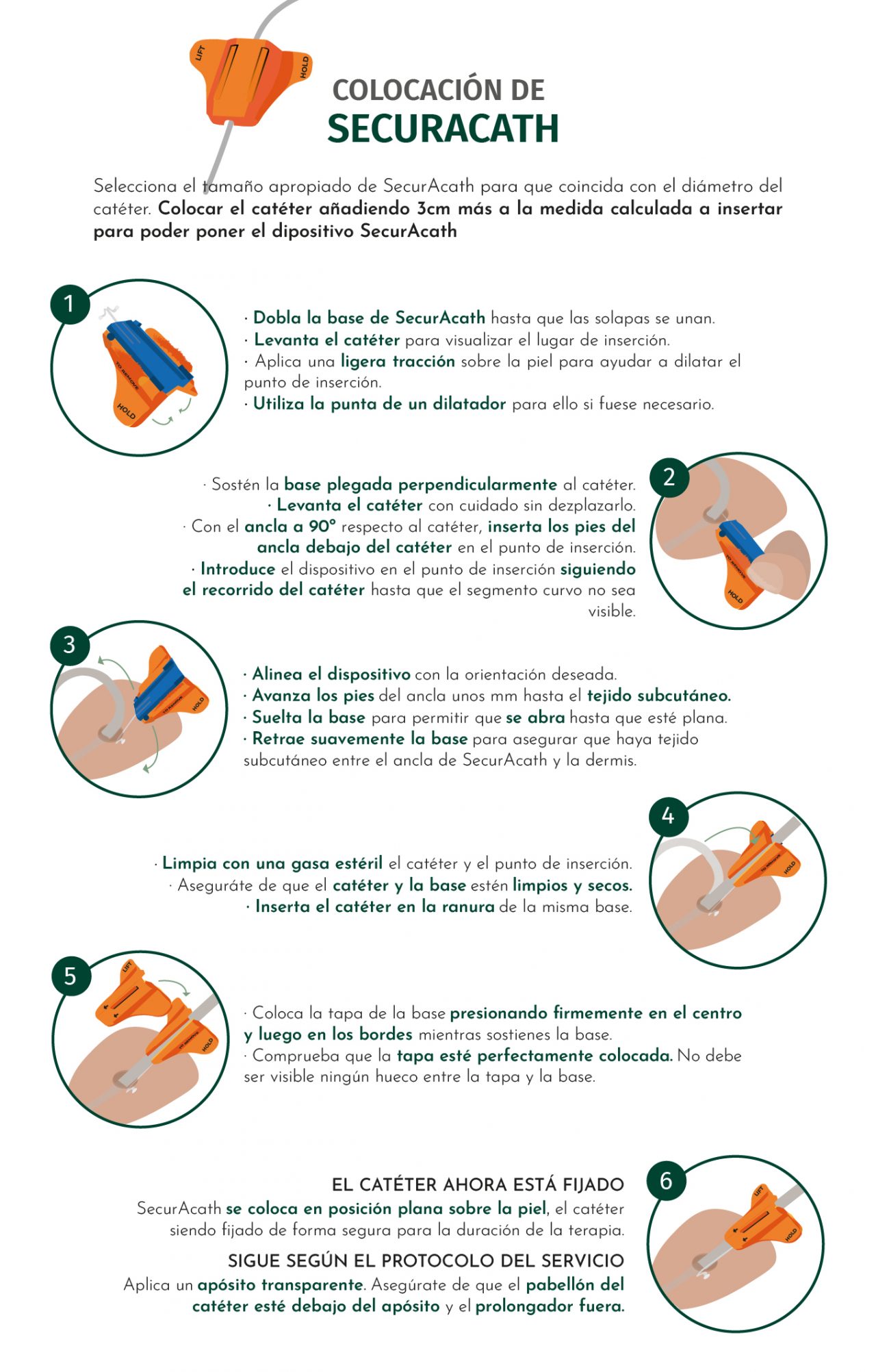 Colocación de SecurAcath - Campus Vygon España