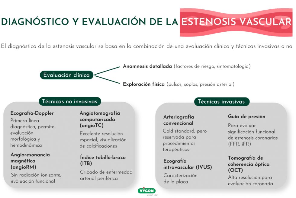 Guía práctica para el abordaje de una estenosis vascular
