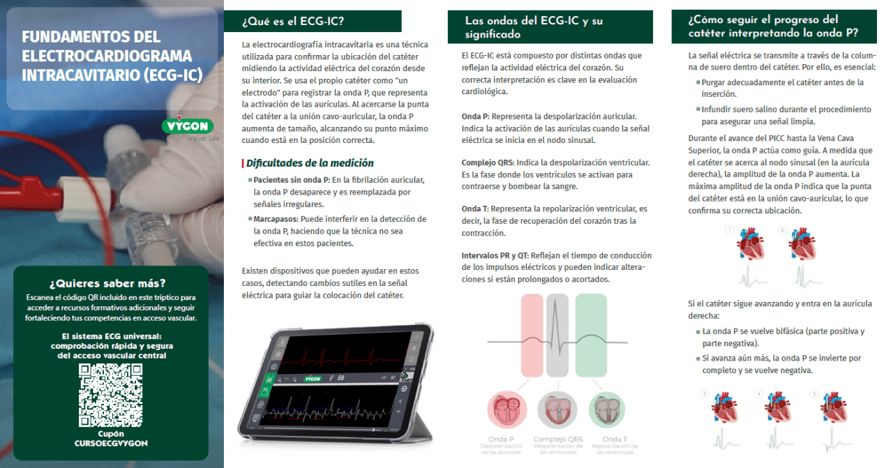 Fundamentos del electrocardiograma intracavitario (ECG-IC) - Campus ...