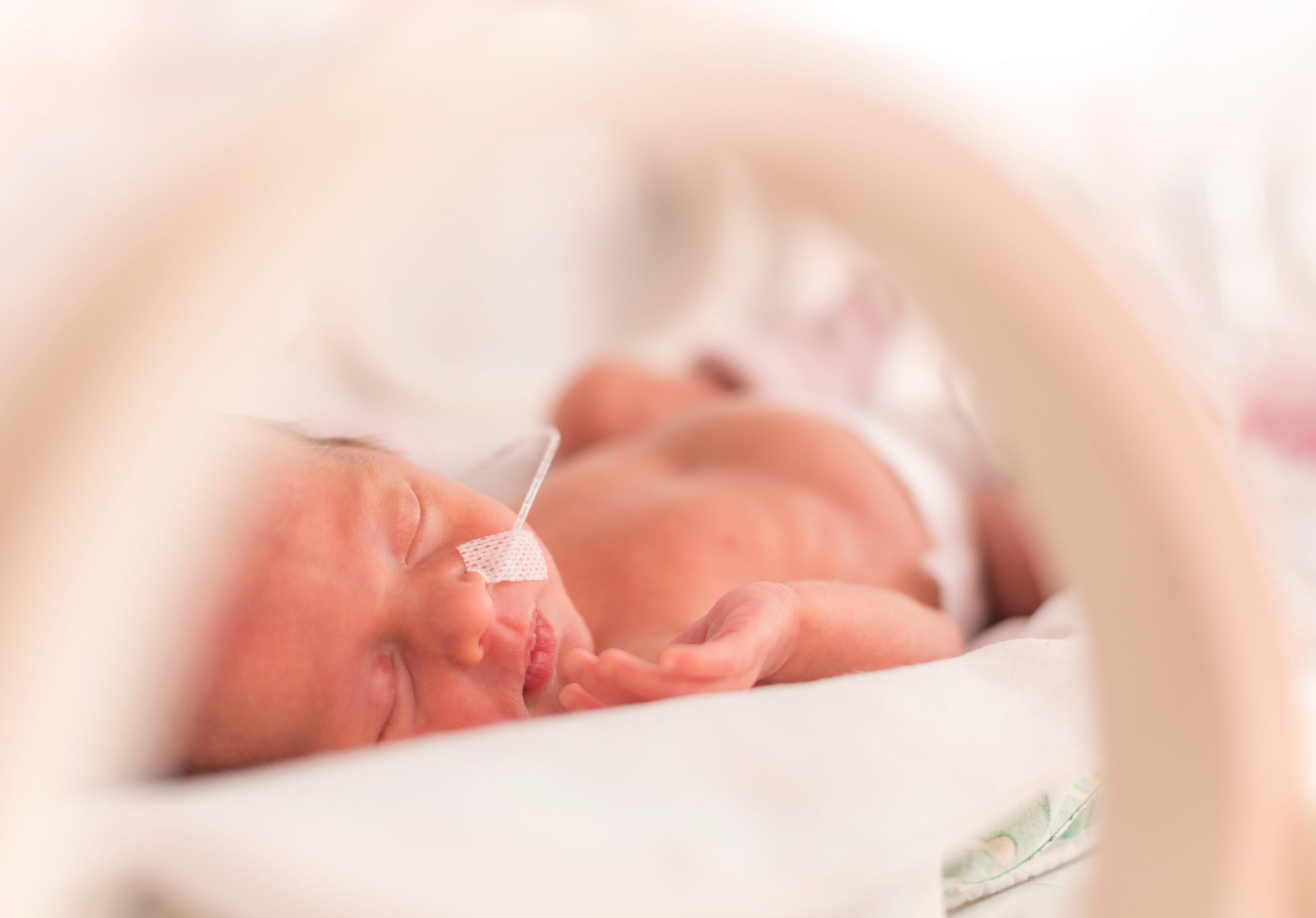 ¿Cómo elegir la zona a puncionar fuera de plano en neonatología?