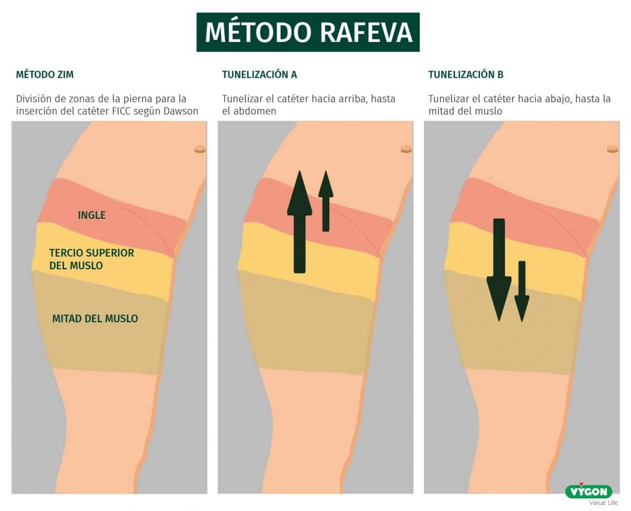Método RaFeVa - Campus Vygon España