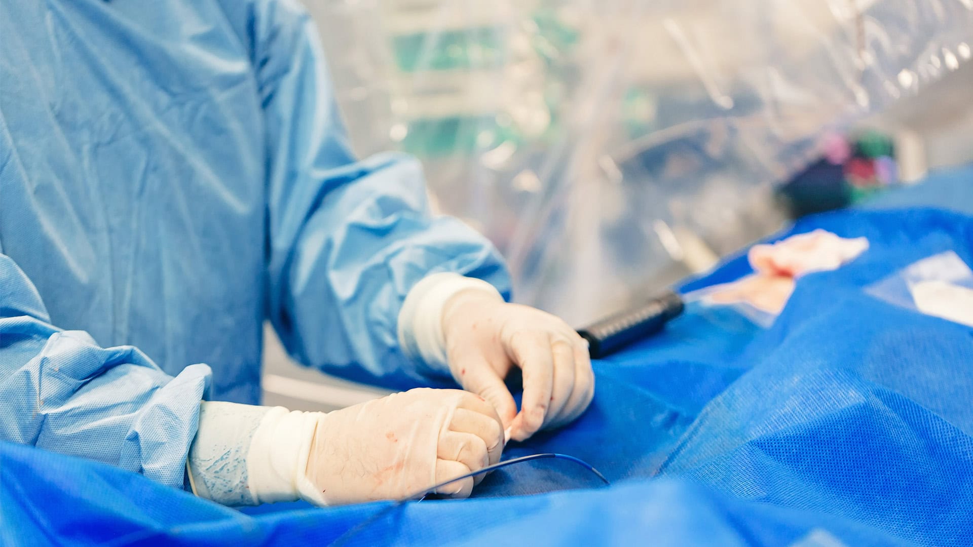 8 claves técnicas para elegir la válvula hemostática que se ajuste a ...