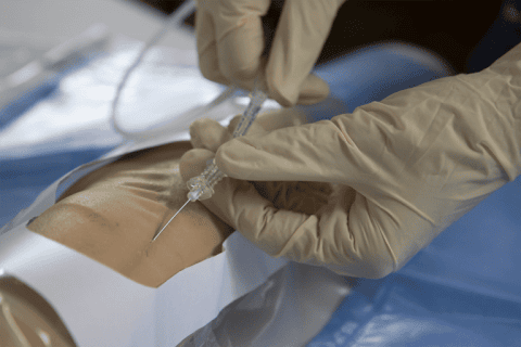 Seldinger technique: when to use the classical or modified method ...