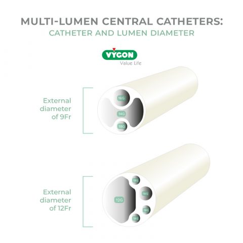 Multi-lumen central catheters: catheter and lumen diameter - Campus ...