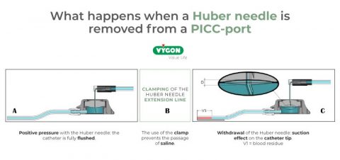 6 measures to ensure the proper functioning of a PICC-port - Campus ...