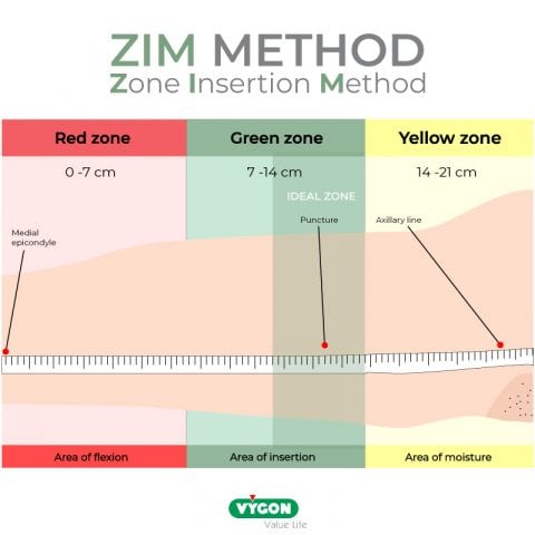 ZIM method and tunnelling in PICC placement - Campus Vygon Global