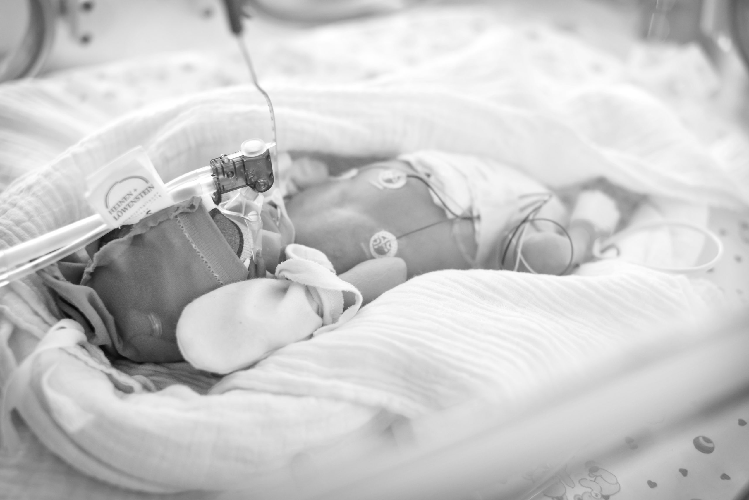 The importance of surfactant in the neonatal patient - Campus Vygon Global