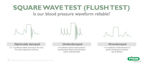 Square wave test (Flush Test) - Campus Vygon Global