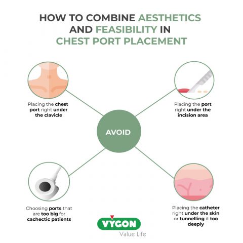 Combining aesthetics and feasibility in chest port placement - Campus ...