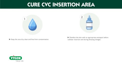 6 Keys to proper care and maintenance of the CVC - Campus Vygon Global