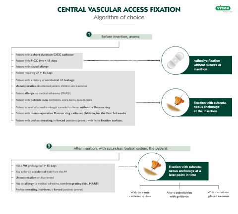 Central venous catheter fixation systems - Campus Vygon Global