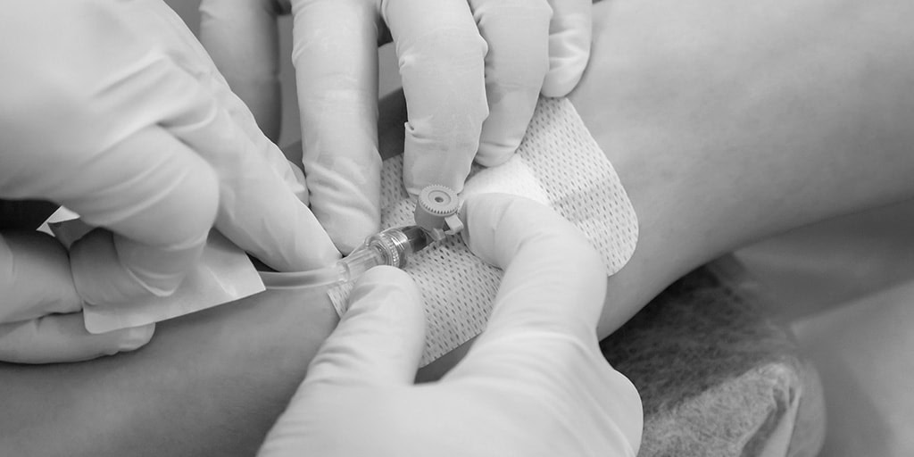 Central venous catheter fixation systems - Campus Vygon Global