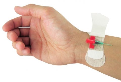 Central venous catheter fixation systems - Campus Vygon Global