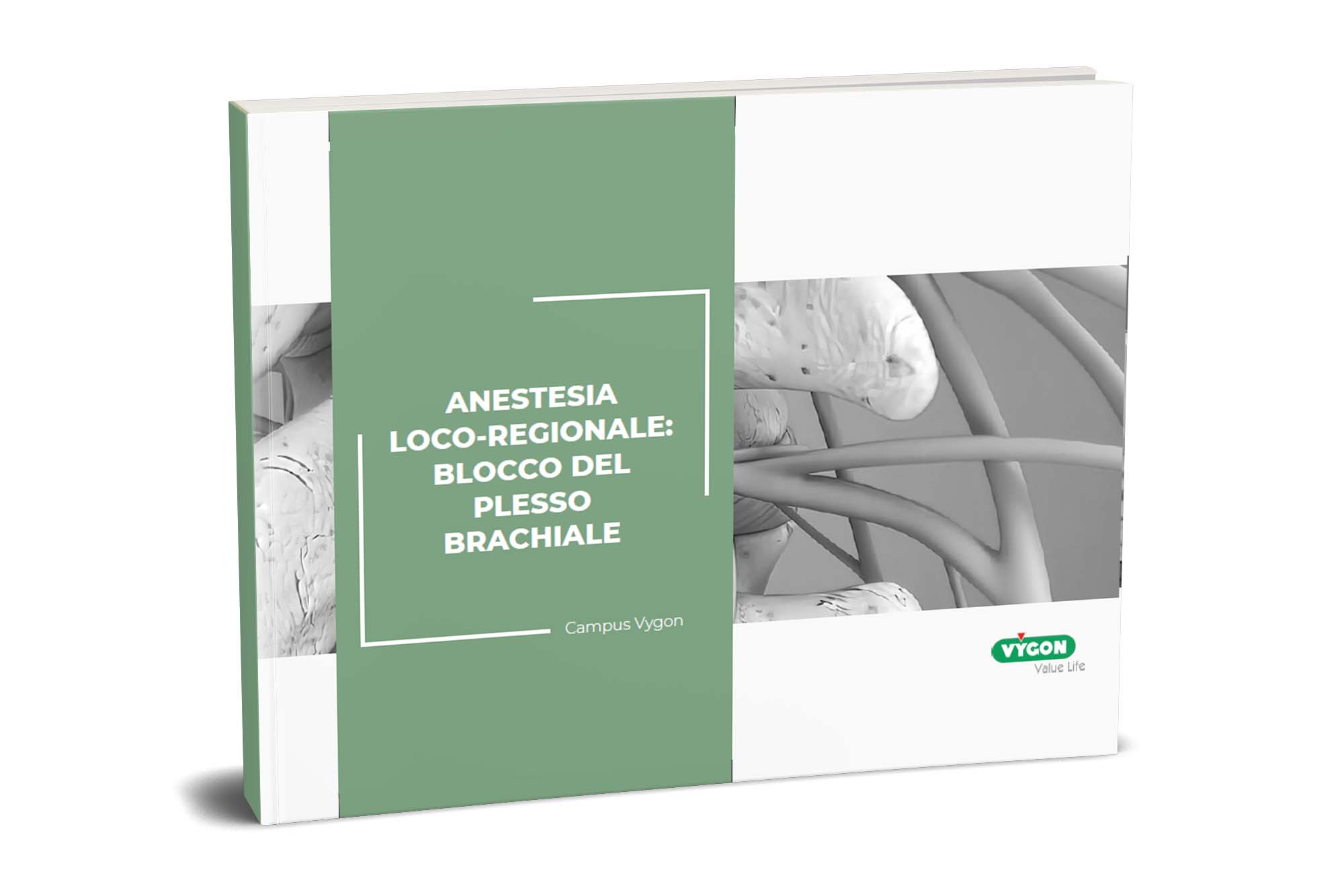 Whitepaper: Anestesia loco-regionale blocco del plesso brachiale Whitepaper: Anestesia loco-regionale blocco del plesso brachiale