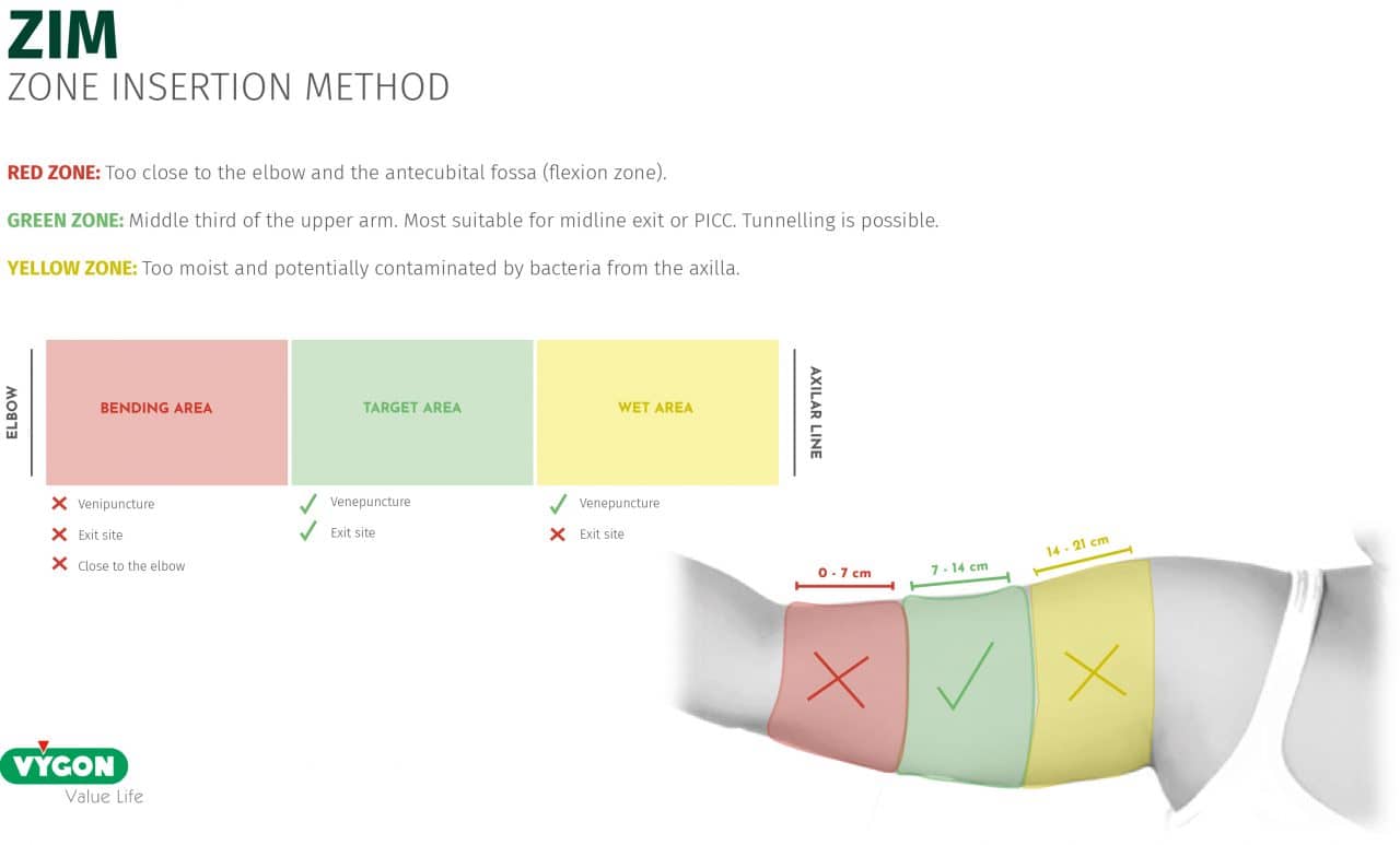 ZIM - Zone Insertion Method - Campus Vygon UK