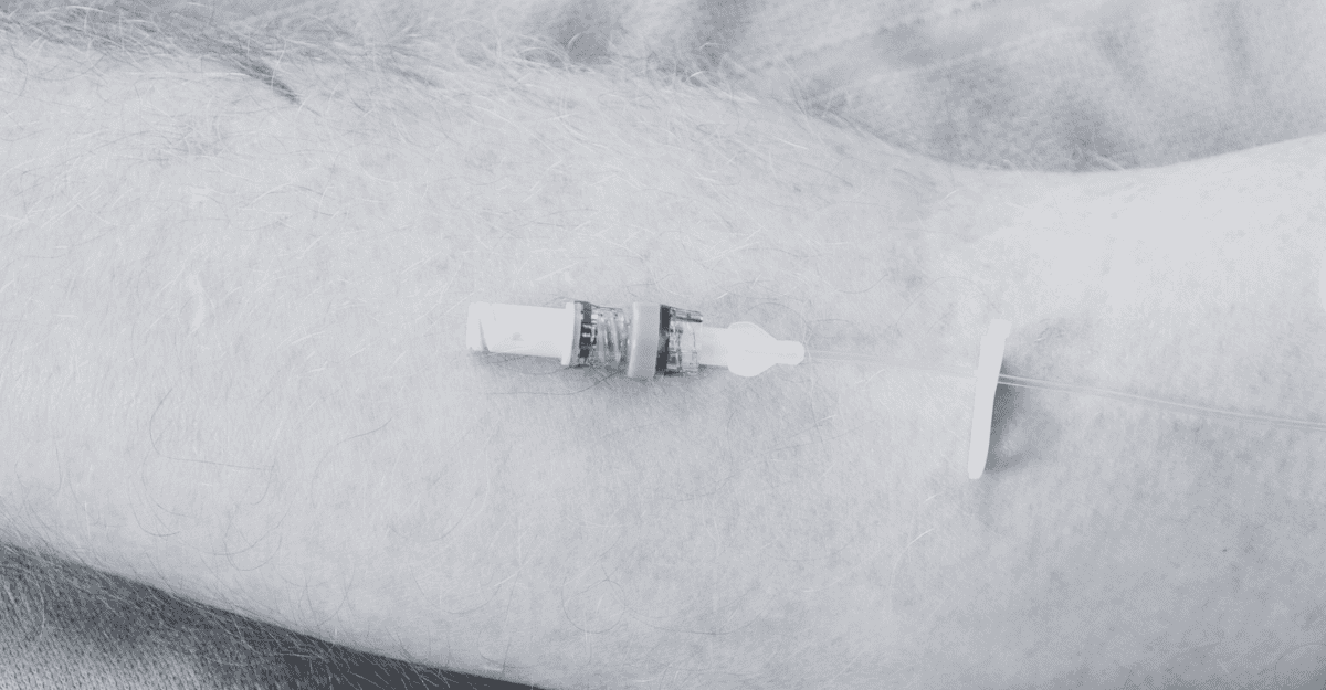 Bionector TKO Clinical Brochure - Campus Vygon UK