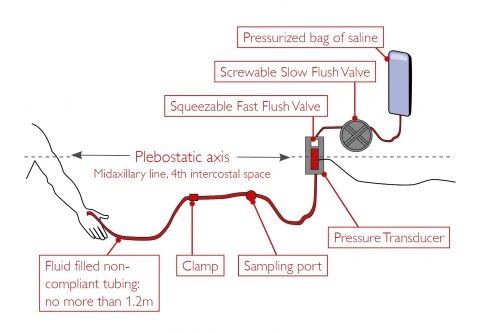 Article 7: Post-Insertion Care, Maintenance & Safe Removal - Campus ...