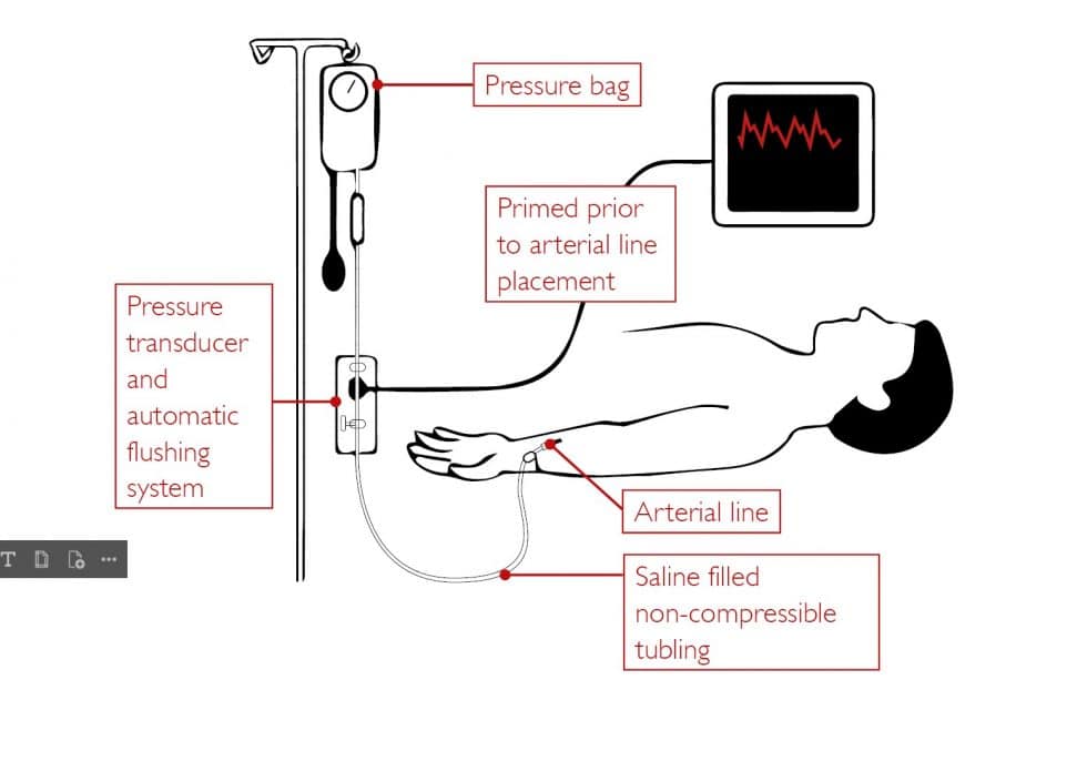 Article 5: Insertion Techniques – From Preparation to Documentation ...