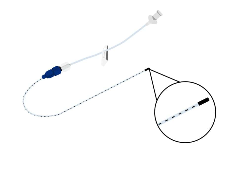 Can Neonatal PICCs Be Cut to Length? A Review of Risks, Evidence, and ...