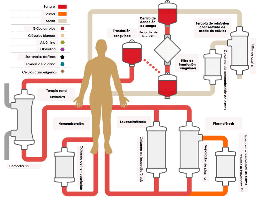 La aféresis terapéutica - Campus Vygon