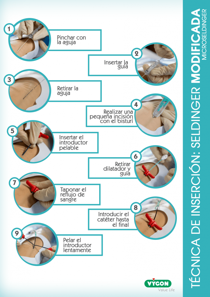La (R)evolución del PICC-port - Campus Vygon