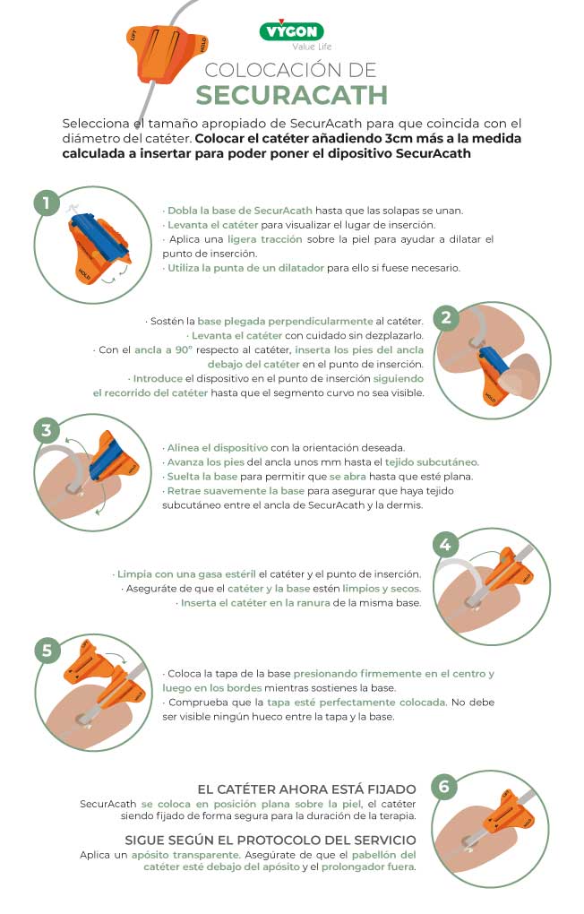 Infografias - Campus Vygon